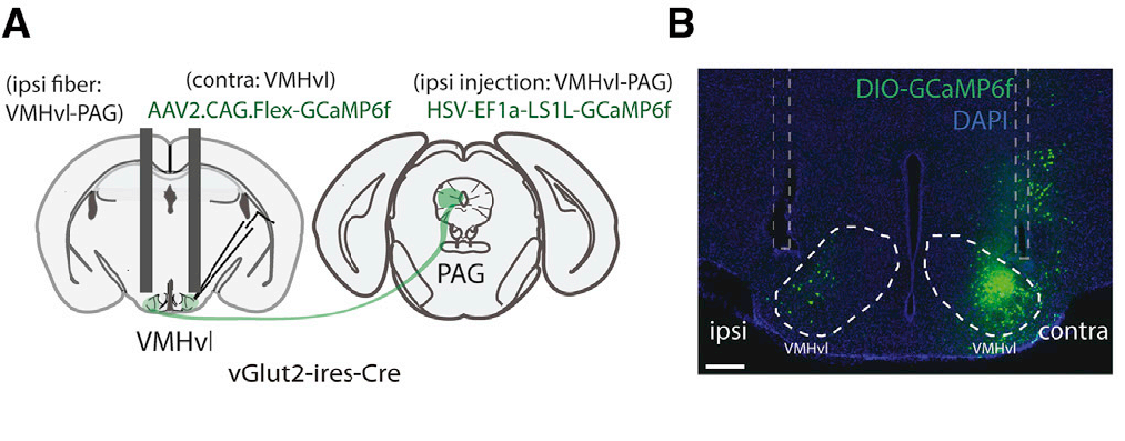 【文献解读】下丘脑参与调控攻击性行为 - 知乎