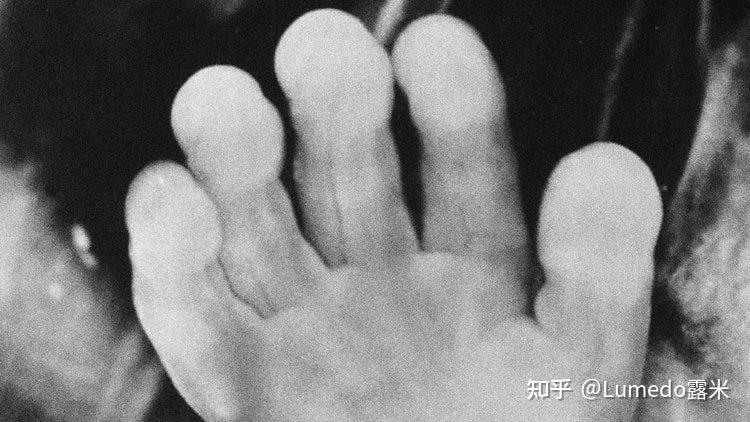 Danny roddy：亚里士多德的散热器，或：背景下的头发生长（二氧化碳、血清素和老龄化的全球降温) - 知乎