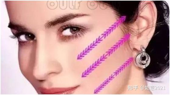 科普篇：ppdo线雕是什么线、做一次线雕能保持多久？ - 知乎