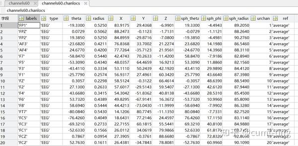 Matlab绘制EEG脑电头皮地形图 - 知乎