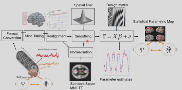 fMRI数据预处理 - 知乎