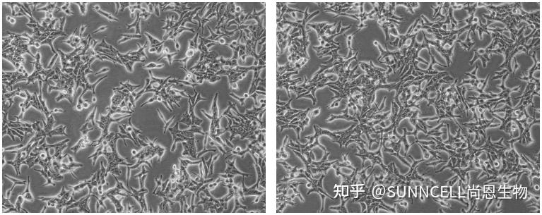 细胞攻略 | C4-2B(人前列腺癌细胞)细胞培养教程 - 知乎