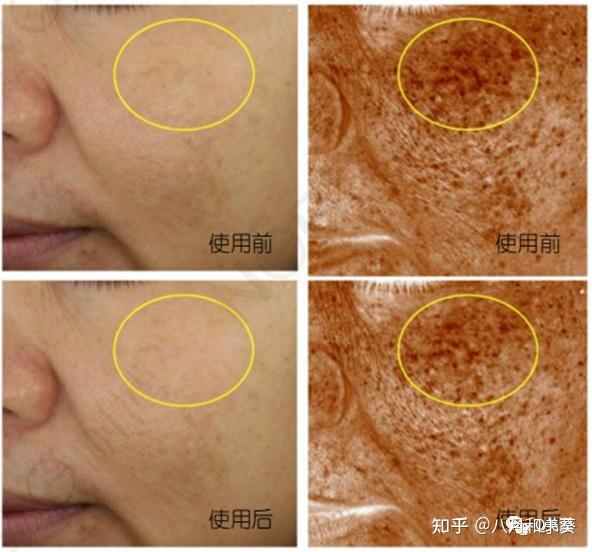 美白化妆品功效评价方法 知乎