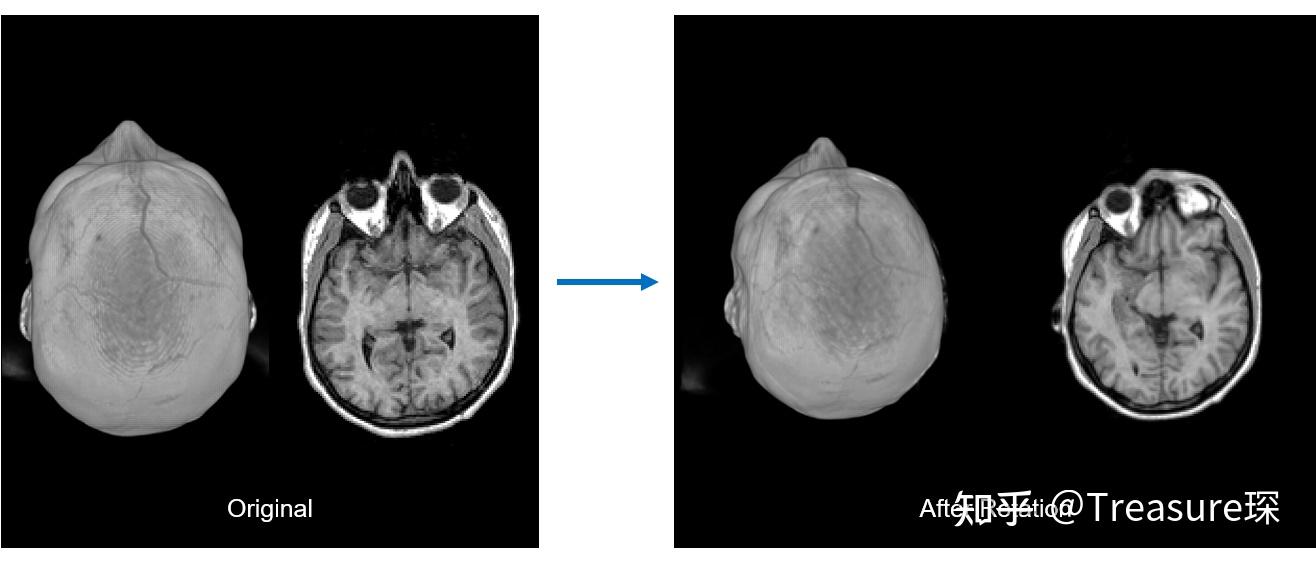ImageJ实用教程——3D Stack Reslice(基本功能篇) - 知乎