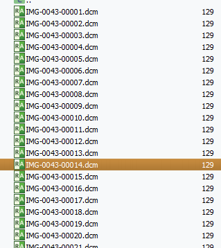 SimpleITK读取医学图像 - 知乎