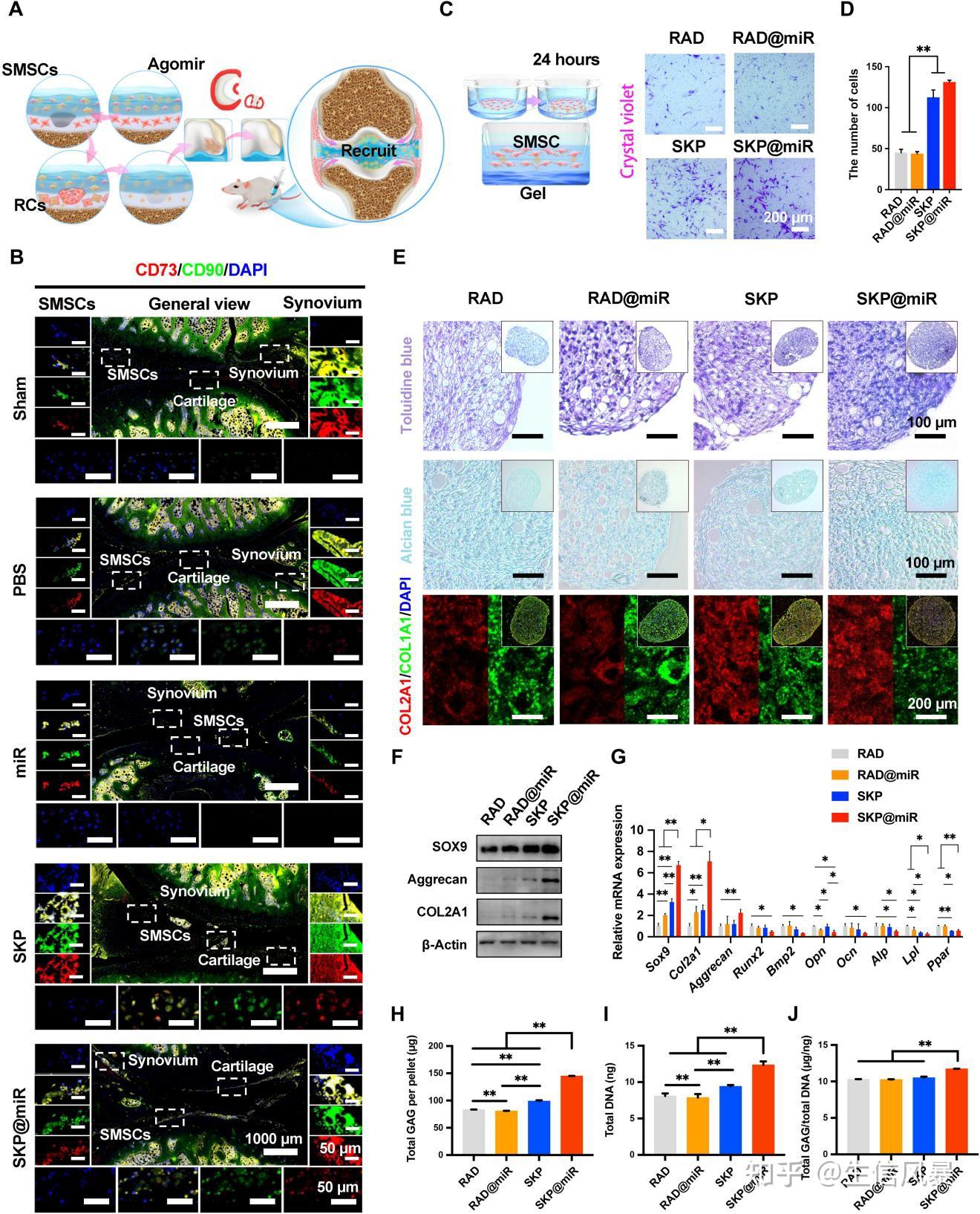 Science:miR-29b-5p通过抑制衰老促进软骨再生 - 知乎