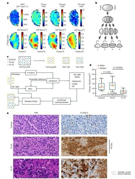 Nat Bio Eng | 德国专家完美匹配PET,MRI与病理图像，检测肿瘤异质性并提高治疗敏感性 - 知乎