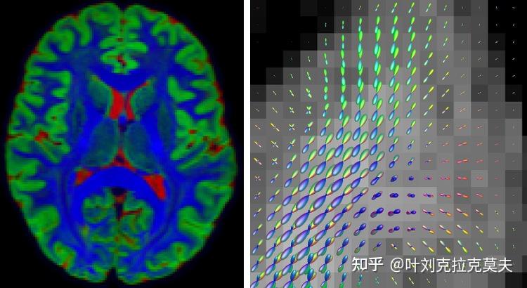 科学可视化软件介绍 – 医学图像处理和可视化开放软件框架MRtrix3 - 知乎