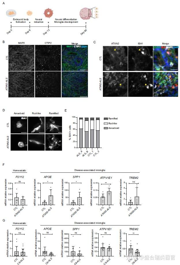 Nature子刊：脑类器官模型证实ATXN2加剧ALS进展 - 知乎