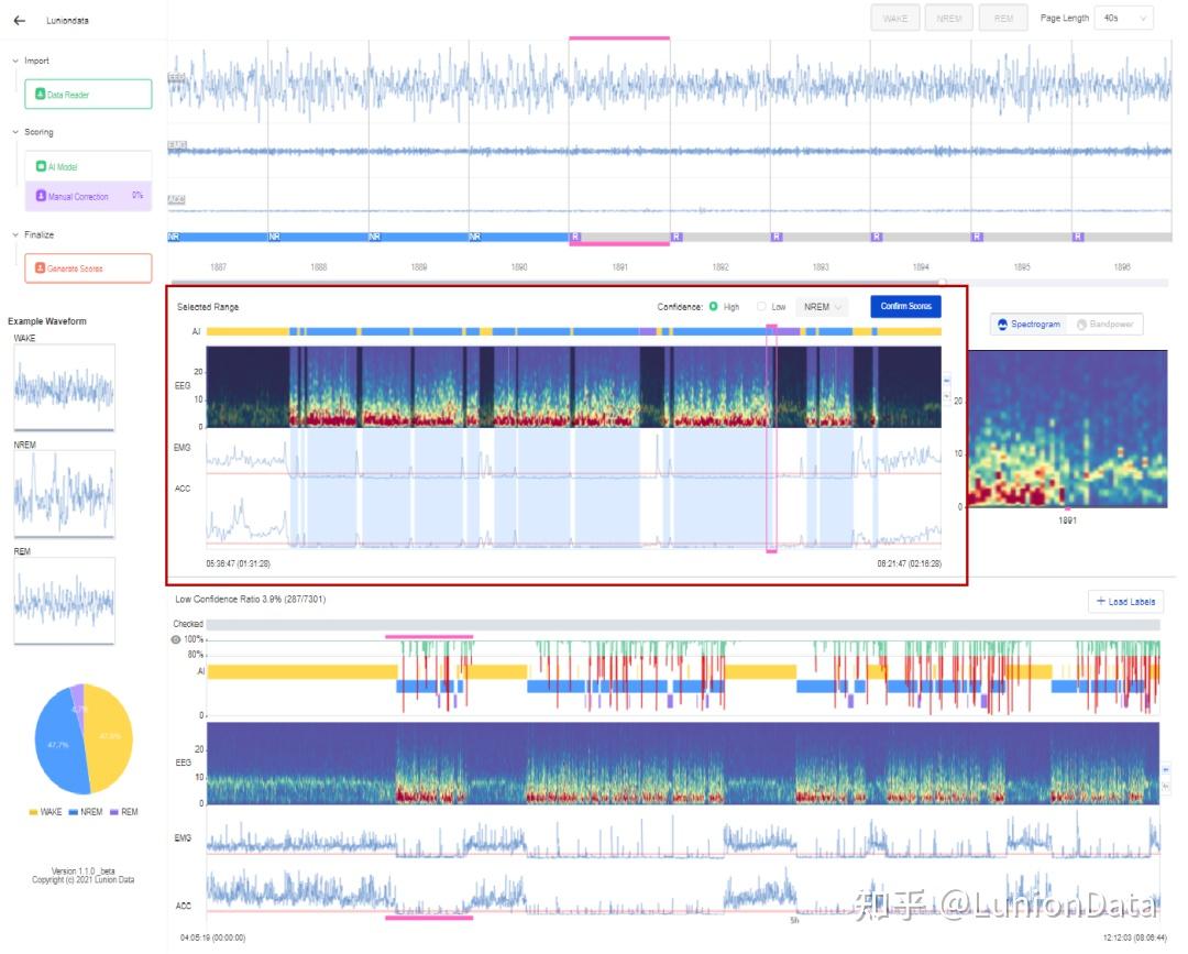 睡眠分期 | Lunion Stage 2分钟视频教程 - 知乎
