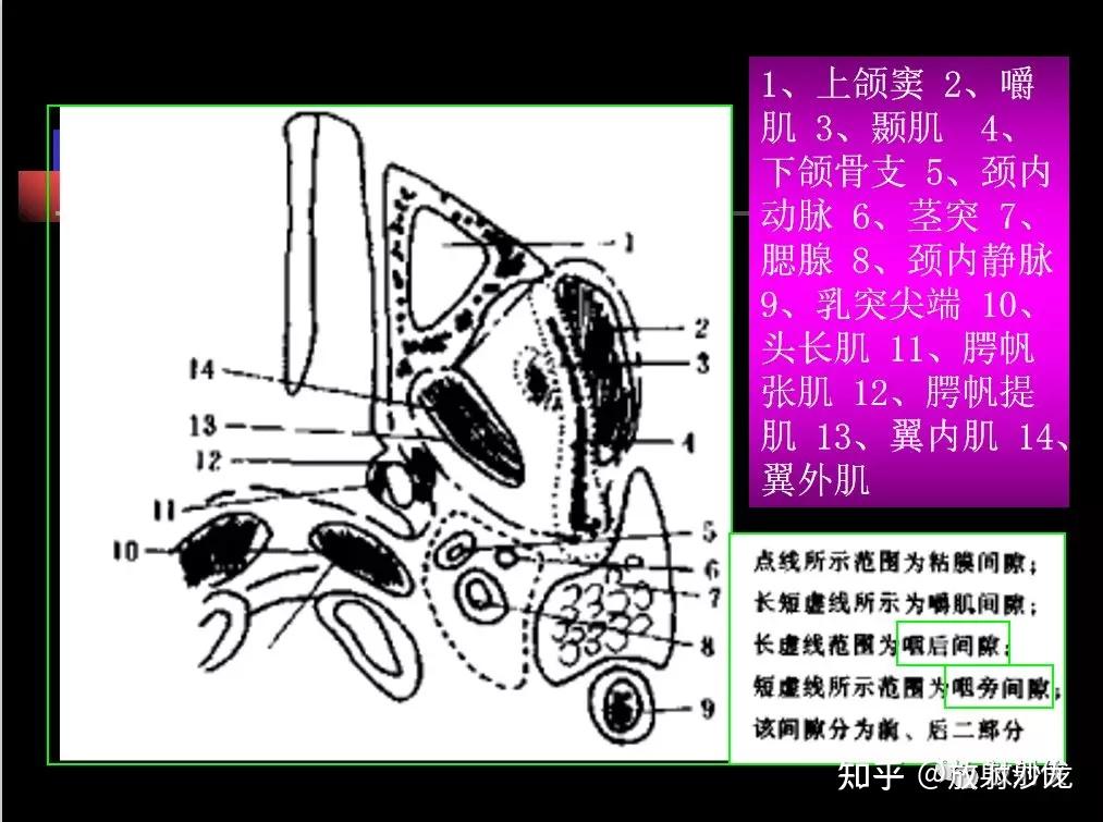 收藏必备 鼻咽部的ct详细解剖 知乎