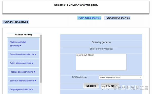 肿瘤免疫 · 实操教程Day10.UALCAN使用教程 - 知乎