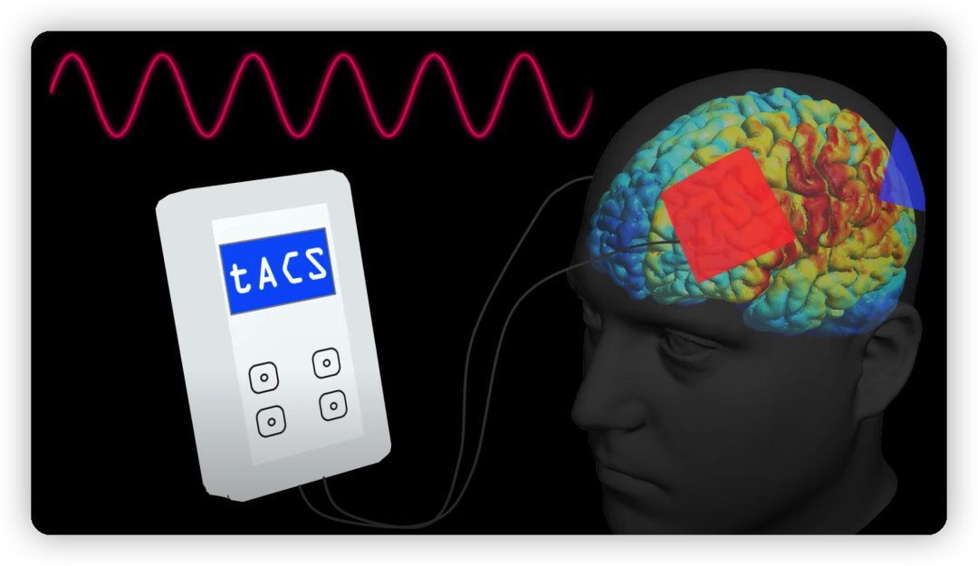 经颅电刺激（tES）技术 - 知乎