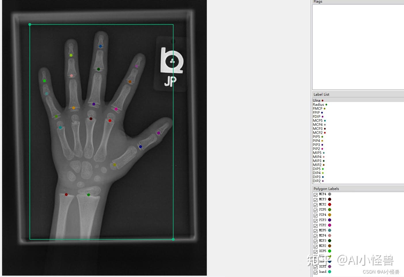 YOLO11-pose关键点检测：自己数据集从labelme标注到生成yolo格式的关键点数据以及训练教程 - 知乎