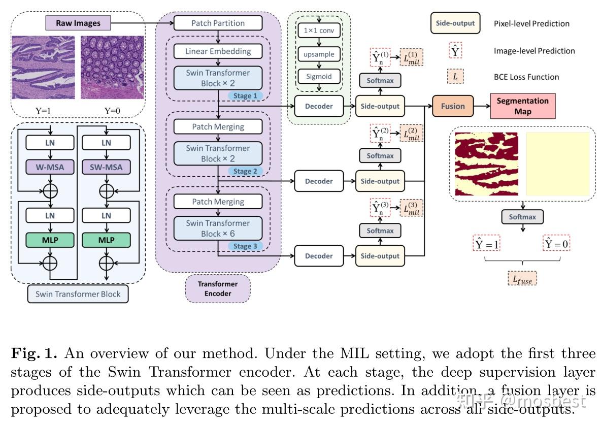 Transformer Based Multiple Instance Learning For Weakly Supervised