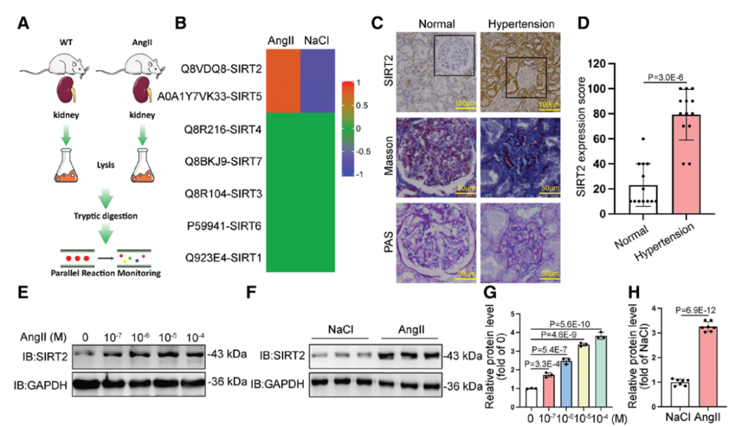 Circ Res封面！中国医科大附一孙英贤团队4D乙酰化修饰组学首次揭示高血压肾损伤关键信号通路 - 知乎