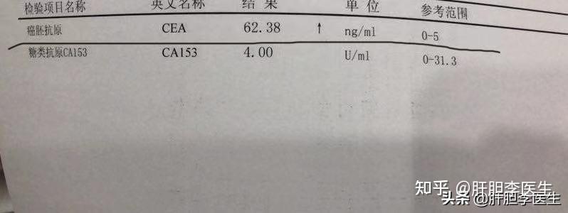 深度解析肿瘤标志物,让你也能看懂化验单上的数字意义 知乎
