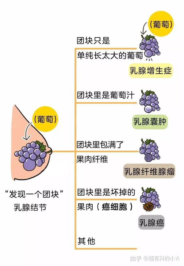 生气真的会长乳腺结节!!! 知乎