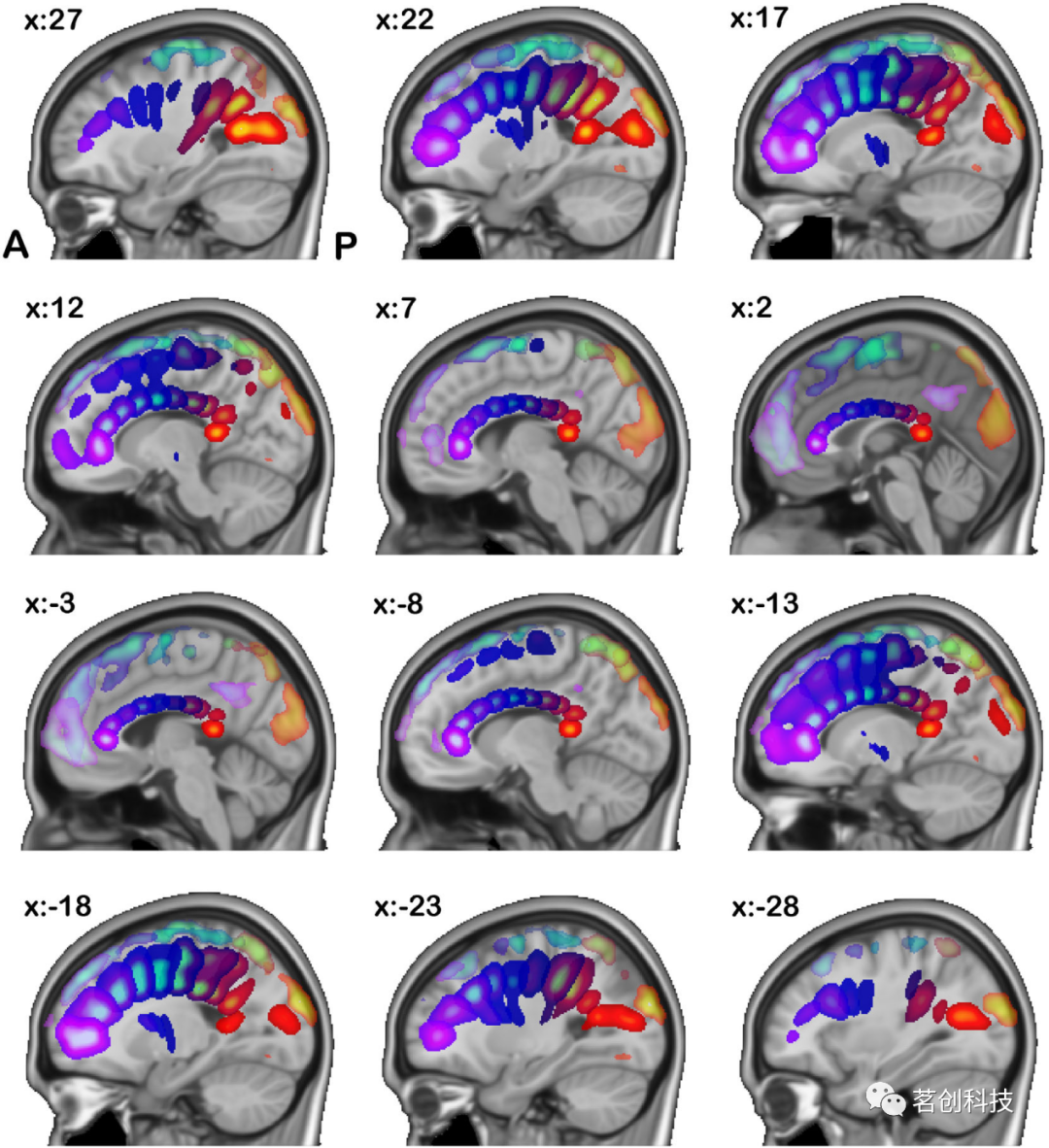 Hum Brain Mapp | 联合连接矩阵独立成分分析：结构和功能连接的自动链接 - 知乎