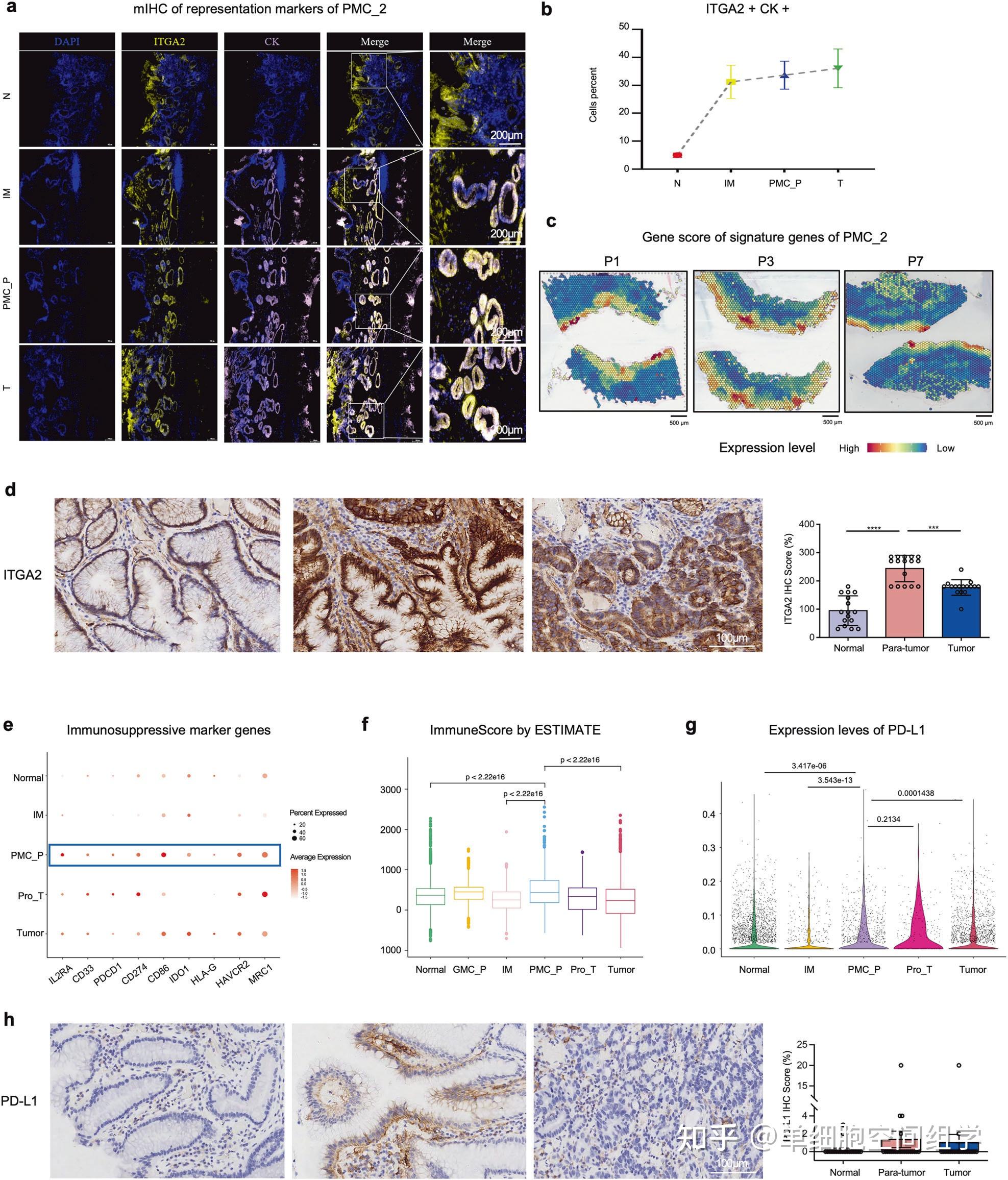 STTT| Tissue Cytometry技术 “解码” 胃癌前关键互作，让 PMC_P 微环境从 【数据猜想】变 【可视化证据】 - 知乎