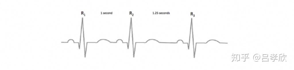 心率变异性（HRV）运动员指南 - 知乎