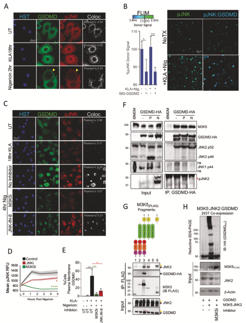 大CDD丨双相 JNK 信号揭示了不同的 MAP3K 复合物引发炎性体形成和细胞焦亡 - 知乎