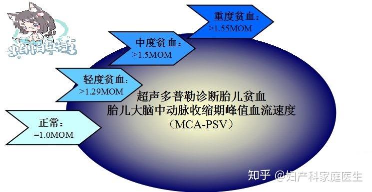 怎么判断胎儿宫内是否贫血？ - 知乎