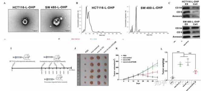 Advanced Science | 外泌体circRNA可编码新型蛋白质诱导结直肠癌细胞自噬并产生奥沙利铂耐药性 - 知乎