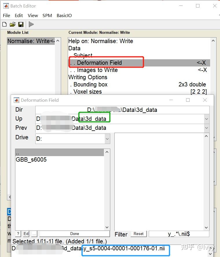 SPM数据预处理 -单被试 - 知乎