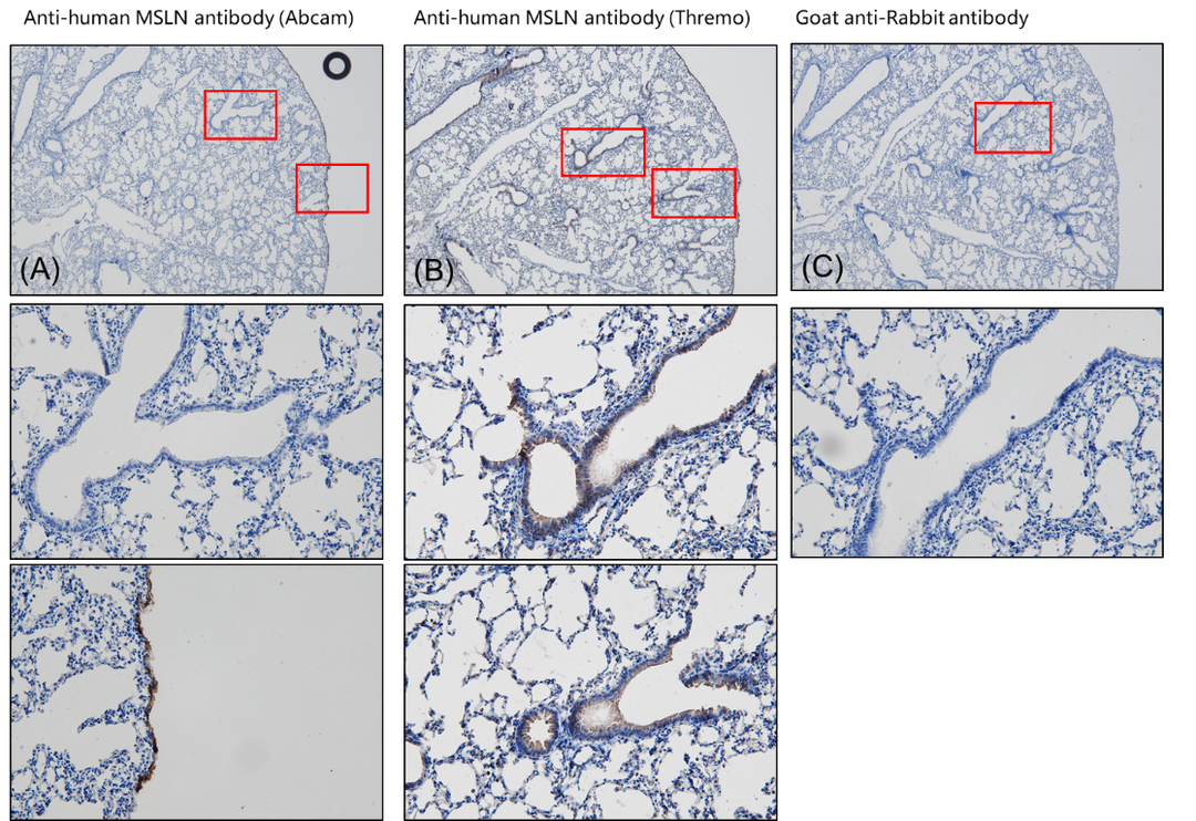 扬帆起航：MSLN靶点治疗带来抗癌治疗“新生机” - 知乎