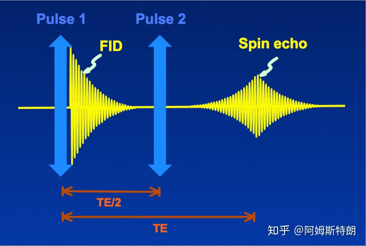 MRI原理简述：从自旋到序列 - 知乎