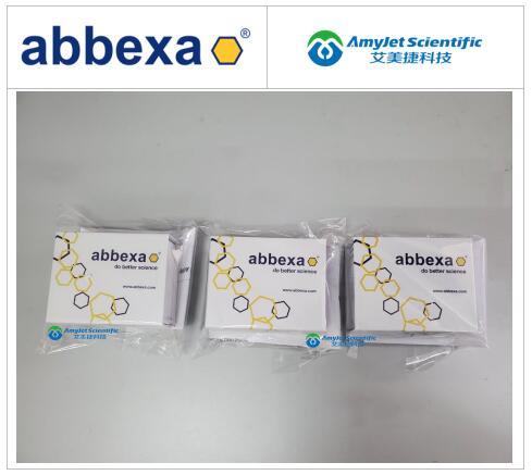 Abbexa丨Abbexa低样本量通用皮质醇ELISA试剂盒原理 - 知乎