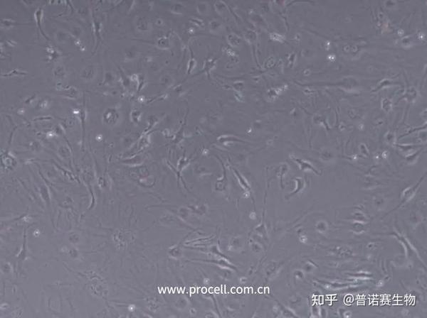 细胞学堂 | 如何解决bEnd.3细胞形态变化、难消化 - 知乎