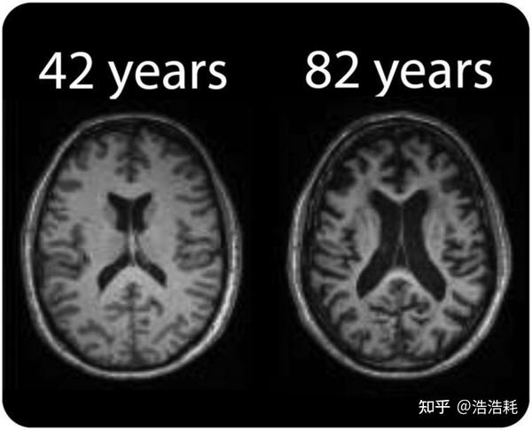 中老年的大脑“危机”该如何缓解？ - 知乎