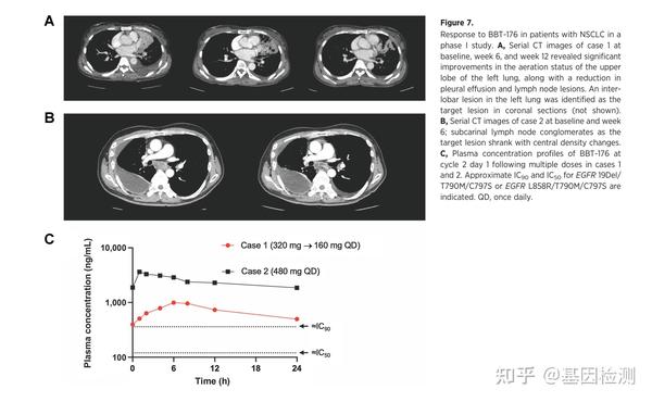 BBT-176，一种新的第四代酪氨酸激酶抑制剂，用于治疗非小细胞肺癌中奥希替尼耐药的EGFR突变 - 知乎
