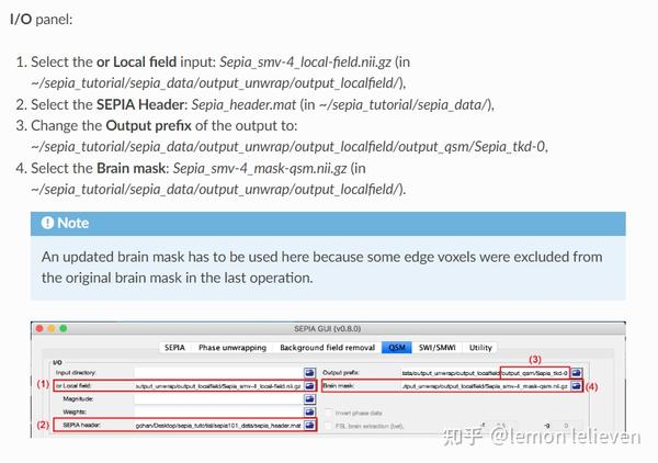 磁化率定量分析（QSM） - 知乎