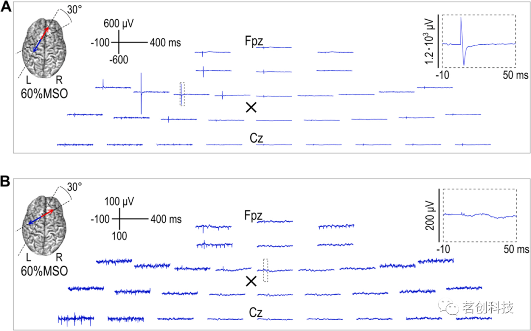 rt-TEP工具：实时显示TMS诱发电位，最大化皮层激活和最小化伪影 - 知乎