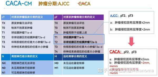 关于黑色素瘤亚型-结膜黑色素瘤的研究进展介绍 - 知乎