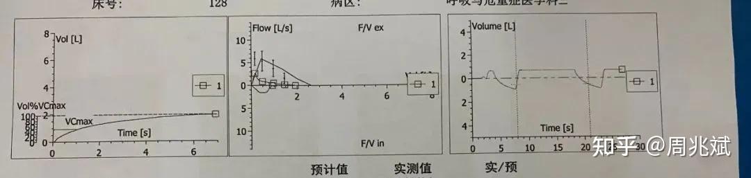 第169期 肺通气功能检查及结果分析 - 知乎