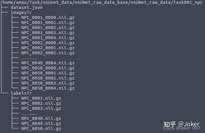 分割模型nnUNet学习日记（一）：在Ubuntu系统下如何快速使用nnUNet跑通自己的数据 - 知乎