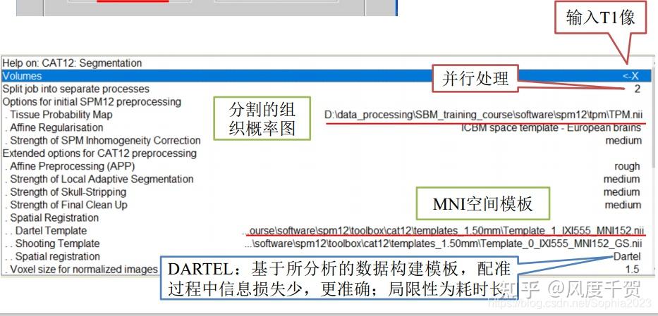 MRI预处理 - 知乎