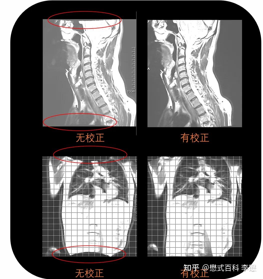 MRI的最大FOV为什么不是扫描孔径的满视野？ - 知乎