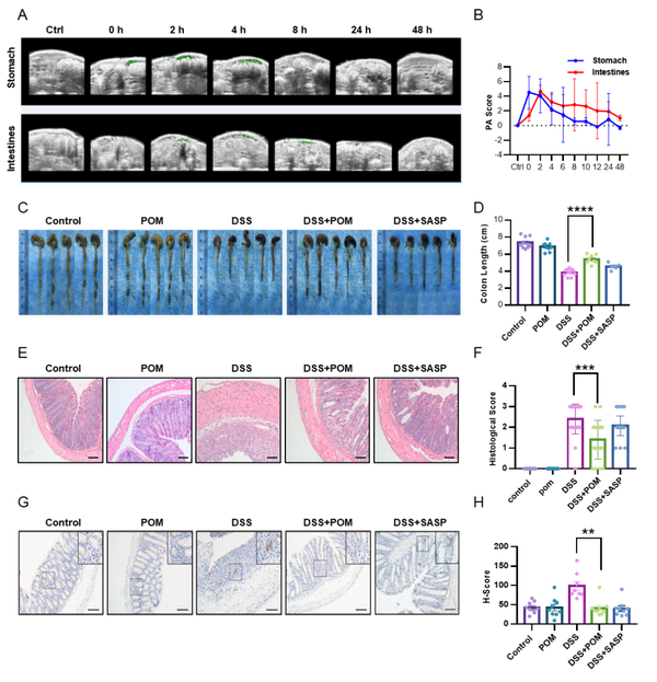 Pharmacol Res︱李丹团队发现钼基多金属纳米团簇（POM）通过清除ROS治疗溃疡性结肠炎 - 知乎
