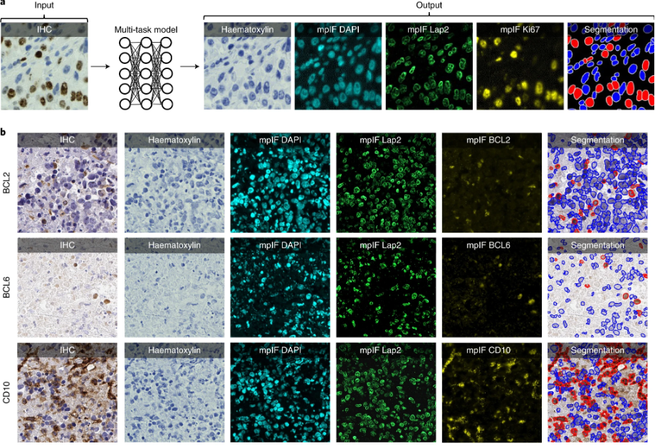 深度学习提取的多重免疫荧光用于免疫组织化学图像定量分析 - 知乎