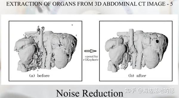 1-4 医学图像处理的流程 - 知乎
