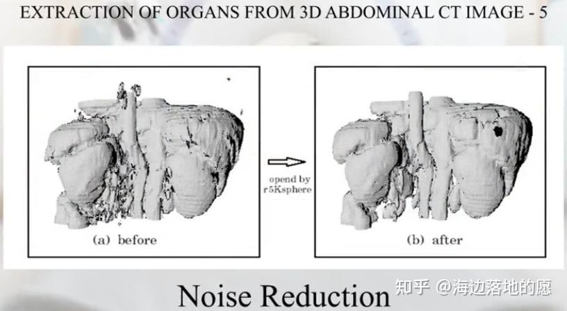 1-4 医学图像处理的流程 - 知乎
