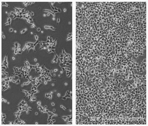 293细胞收货后怎样判断细胞状态是否异常？ - 知乎