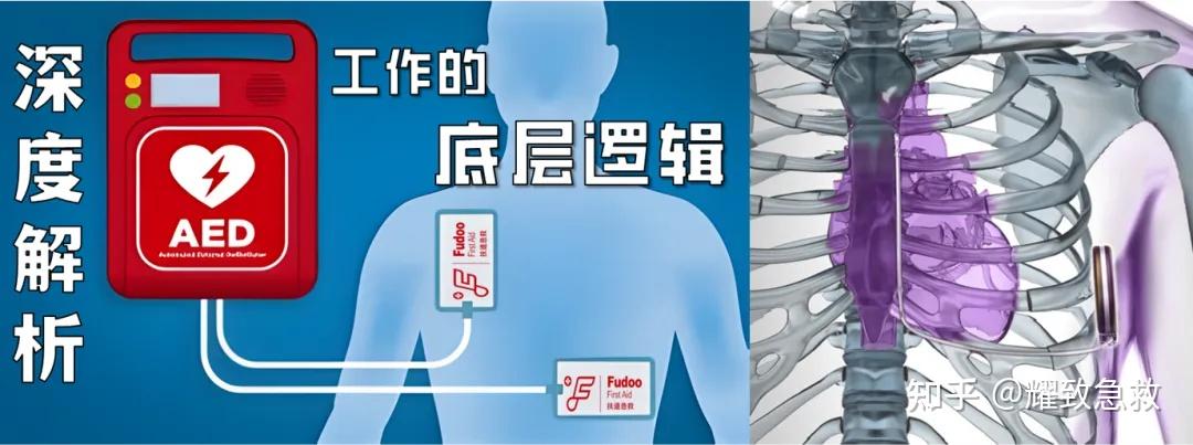 深度解析“救命神器”AED的工作原理 - 知乎