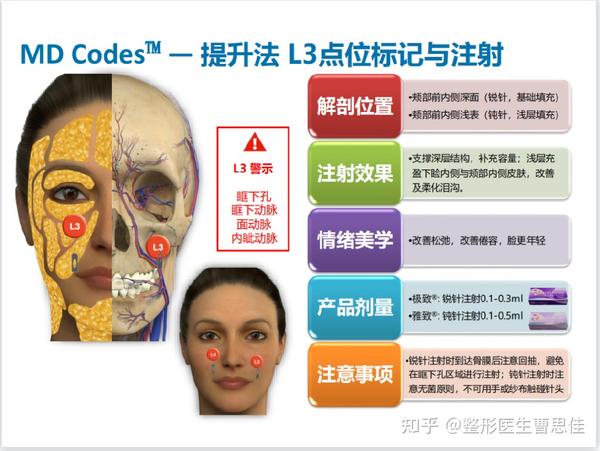 MD Codes 注射法，我为什么不教！ - 知乎