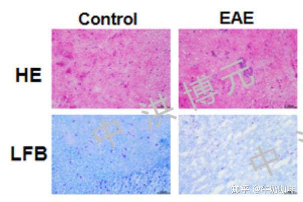 自身免疫性脑脊髓炎（EAE）动物模型的建立 - 知乎